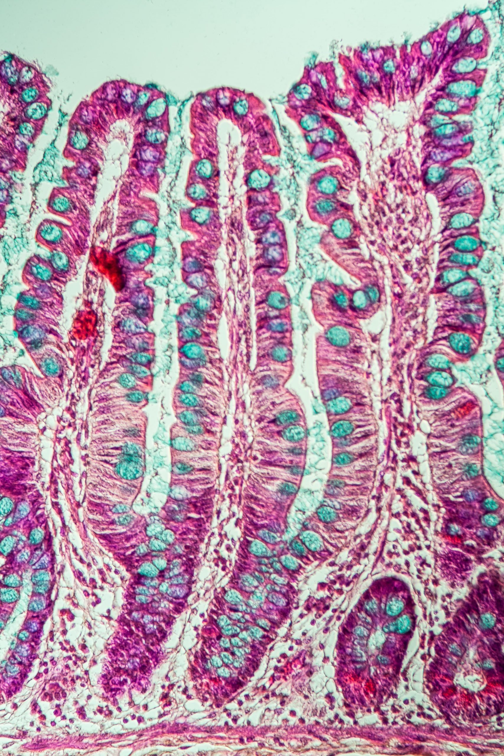 The Curvaceous Small Intestine And Better Health - Yes Healthier